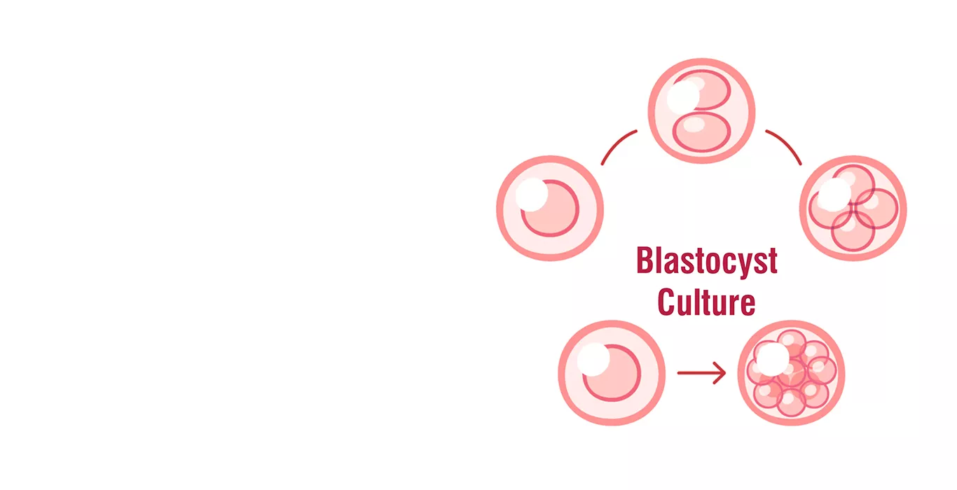 Frozen Blastocyst Transfer & Embryo Implantation | Indira IVF