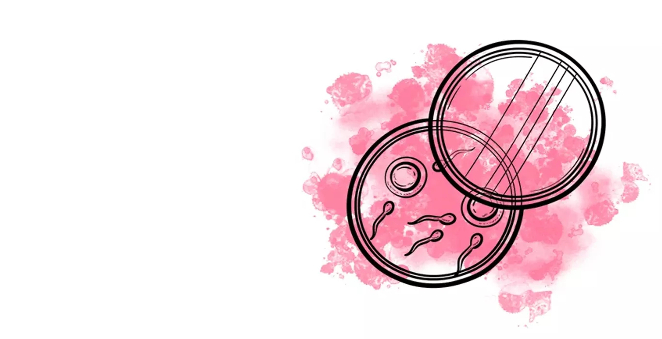 Laser Assisted Hatching (LAH) Treatment in IVF | Indira IVF