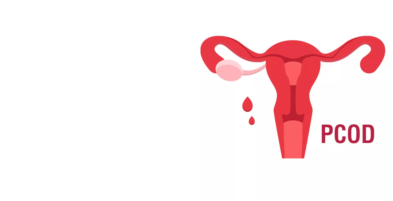 PCOD Causes: What are the Causes of PCOD | Indira IVF